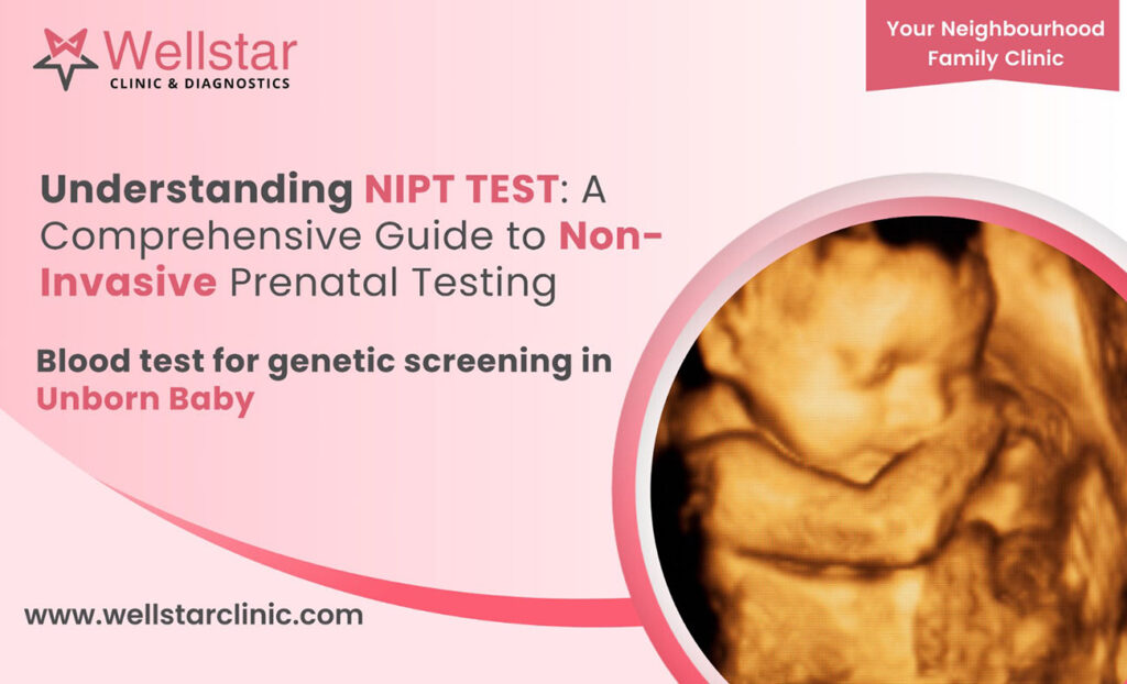 Understanding Nipt Test A Comprehensive Guide To Non Invasive Prenatal
